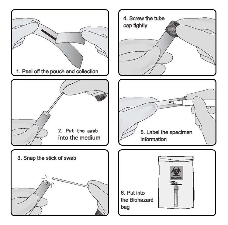 Viral Transport Tube